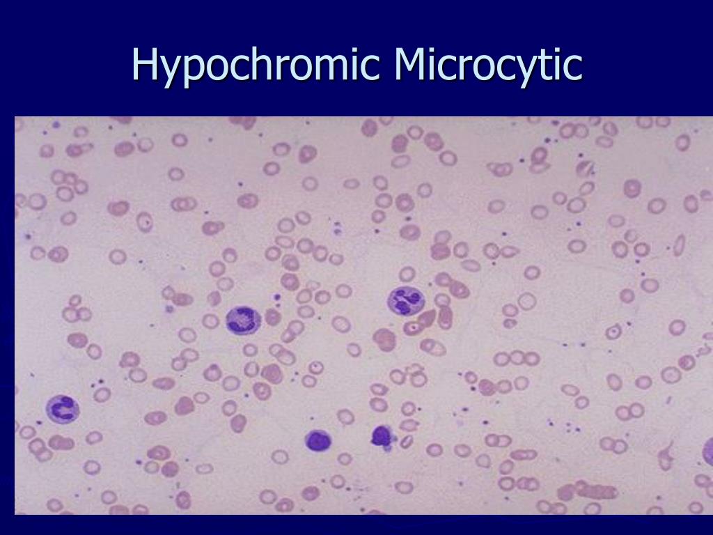 PPT - Red Cell Indices and Anemia Classification Guide PowerPoint ...