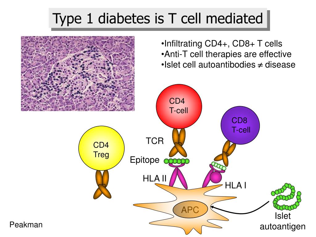 Antibodies Are Type 1 Diabetes at Jerrod Daily blog Antibodies Are Type 1 Diabetes at Jerrod Daily blog