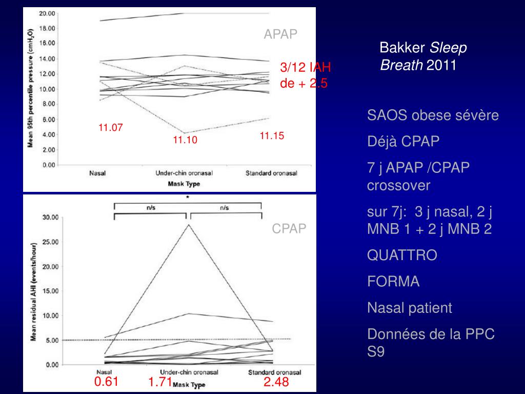PPT - Stratégie de prise en charge du SAOS PowerPoint Presentation ...