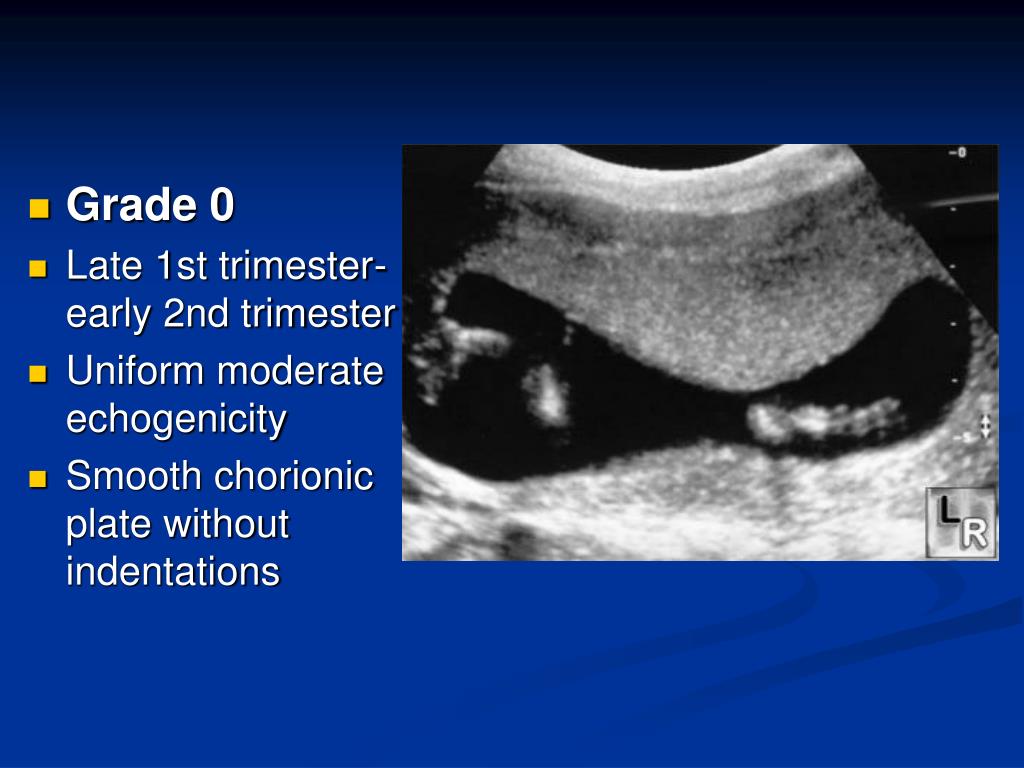 PPT Placental US PowerPoint Presentation Free Download ID 3356735 PPT Placental US PowerPoint Presentation Free Download ID 3356735