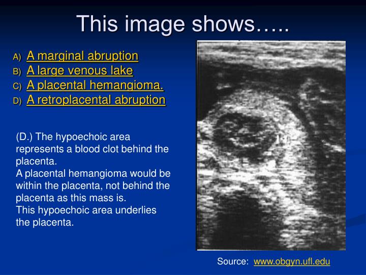 PPT - Placental US PowerPoint Presentation - ID:3356735