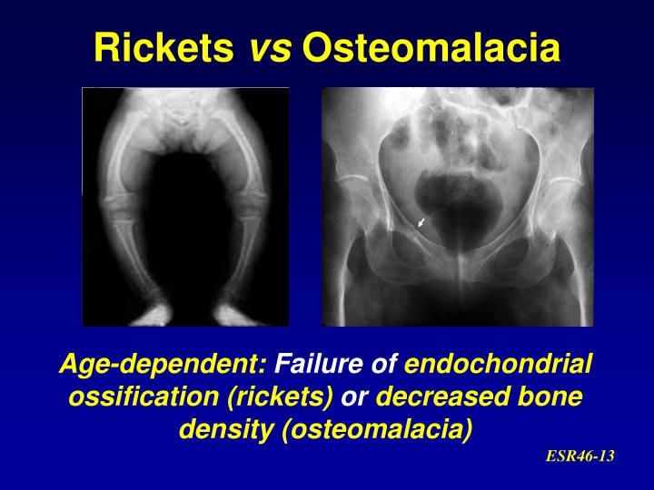 PPT - ENDOCRINE CONTROL OF CALCIUM HOMEOSTASIS PowerPoint Presentation ...