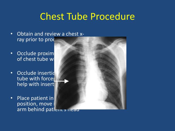 PPT - Chest Tube Insertion and Needle Decompression PowerPoint ...