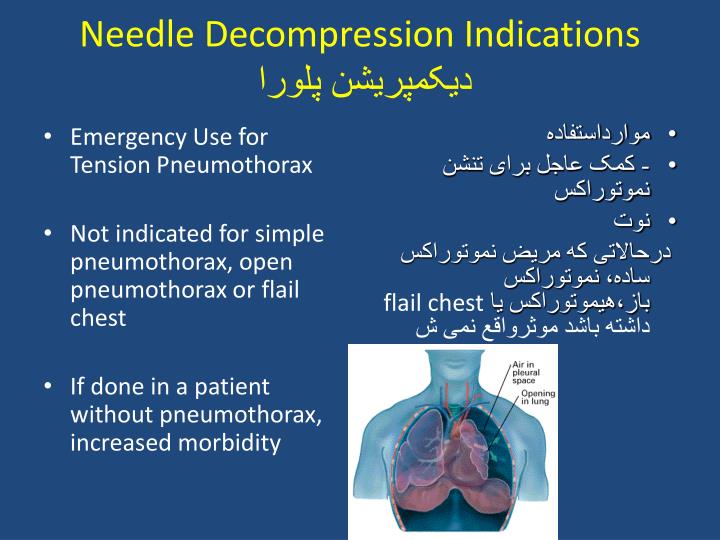 PPT - Chest Tube Insertion and Needle Decompression PowerPoint ...