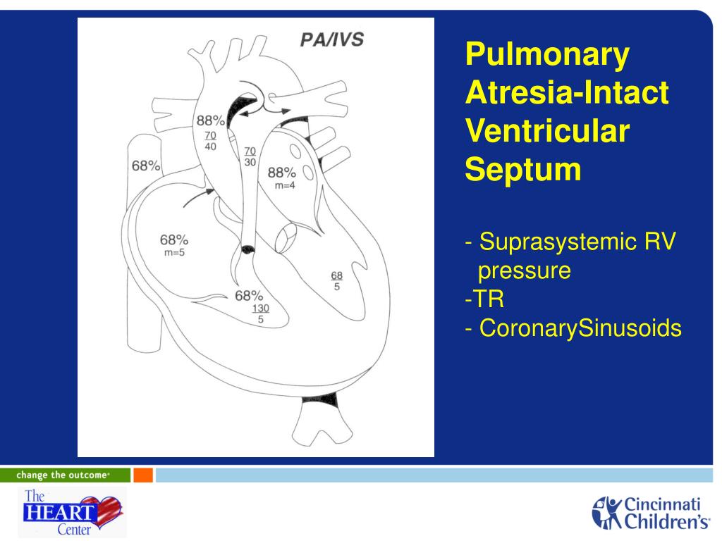 PPT - Critical Congenital Heart Disease in the Newborn: Anatomy ...