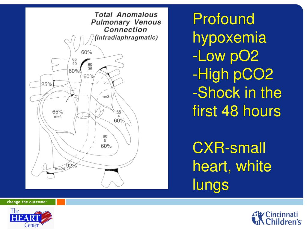 PPT - Critical Congenital Heart Disease in the Newborn: Anatomy ...
