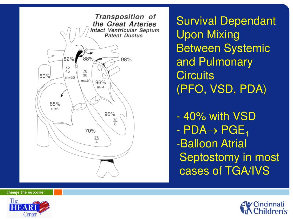 PPT - Critical Congenital Heart Disease in the Newborn: Anatomy ...