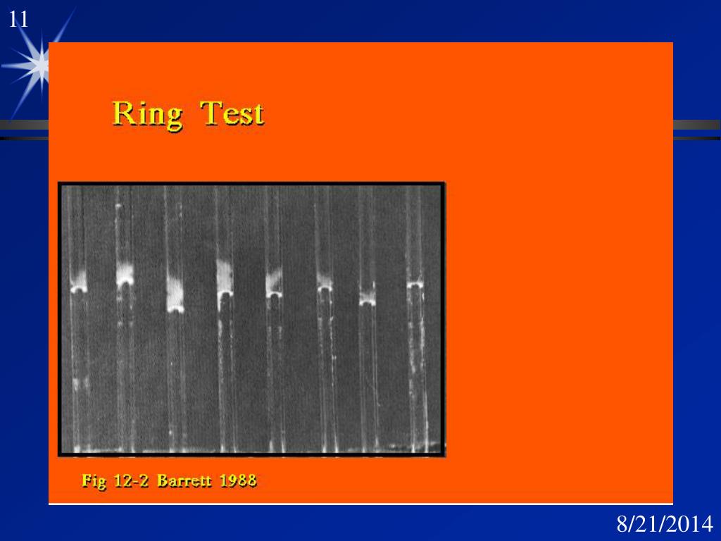 PPT - Antigen - Antibody Interactions Precipitin Reactions PowerPoint ...