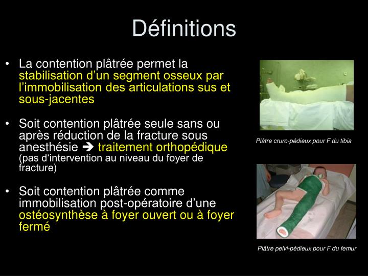 PPT - Surveillance d’un malade sous plâtre Indications – Modalités ...