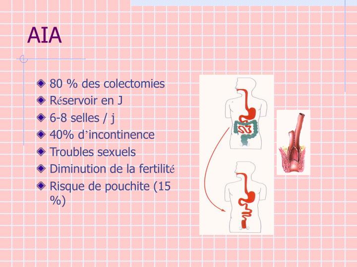 PPT - LA RECTOCOLITE HEMORRAGIQUE PowerPoint Presentation - ID:3361286