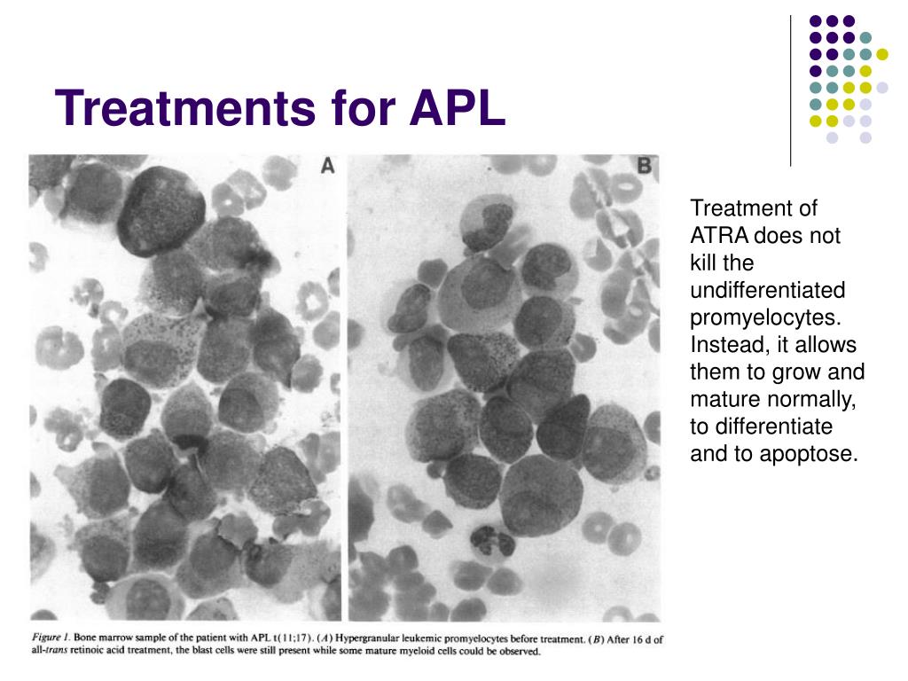 PPT - Retinoic Acid Receptor-Alpha and Its Role in Acute Promyelocytic ...