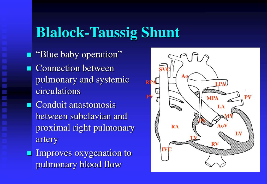 PPT - Congenital Heart Disease in Adult PowerPoint Presentation, free ...