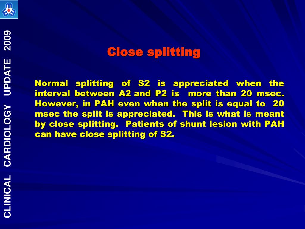 PPT - Second Heart Sound in Congenital Heart Disease PowerPoint ...