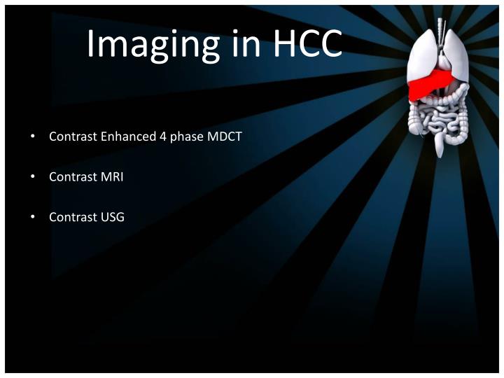 PPT - Multidisciplinary approach to HCC PowerPoint Presentation - ID ...