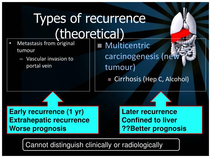 PPT - Multidisciplinary approach to HCC PowerPoint Presentation - ID ...