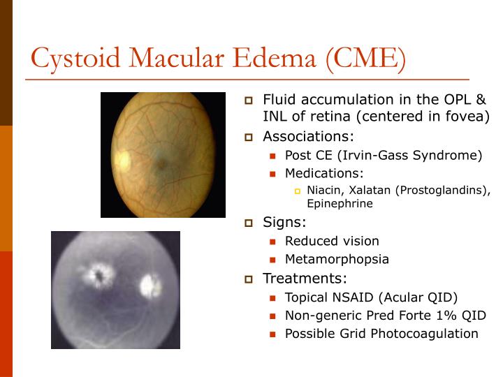 PPT - Common Posterior Pole Disorders PowerPoint Presentation - ID:3364585