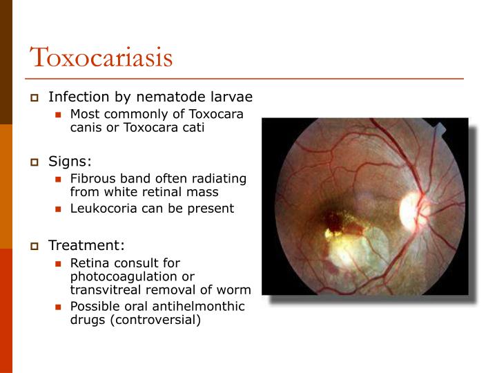 PPT - Common Posterior Pole Disorders PowerPoint Presentation - ID:3364585