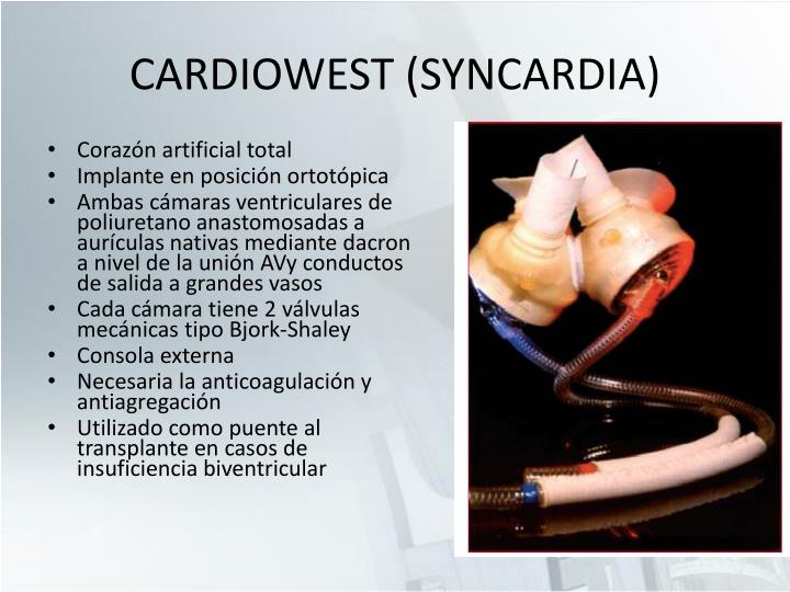 PPT - ASISTENCIAS VENTRICULARES PowerPoint Presentation - ID:3366512