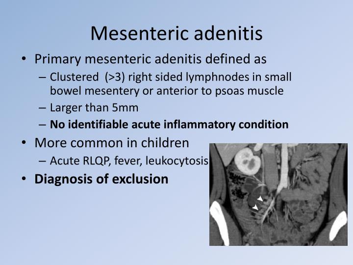 PPT - Right iliac fossa pain – modality directed diagnostic approach ...