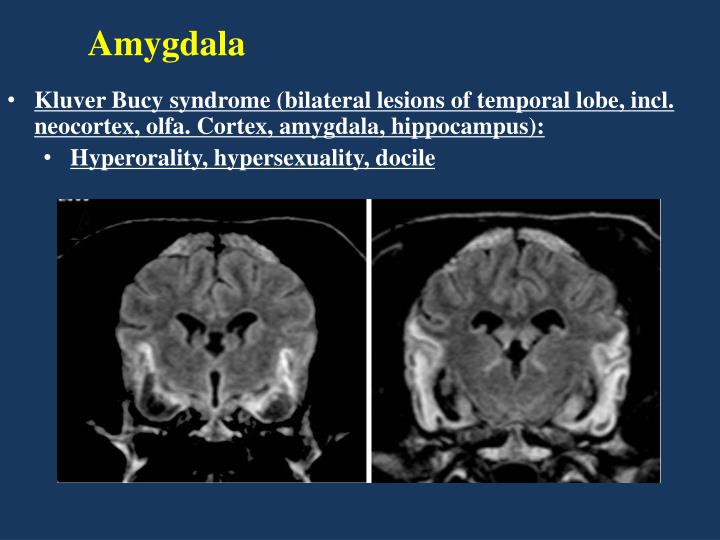 PPT - Limbic System PowerPoint Presentation - ID:3366769