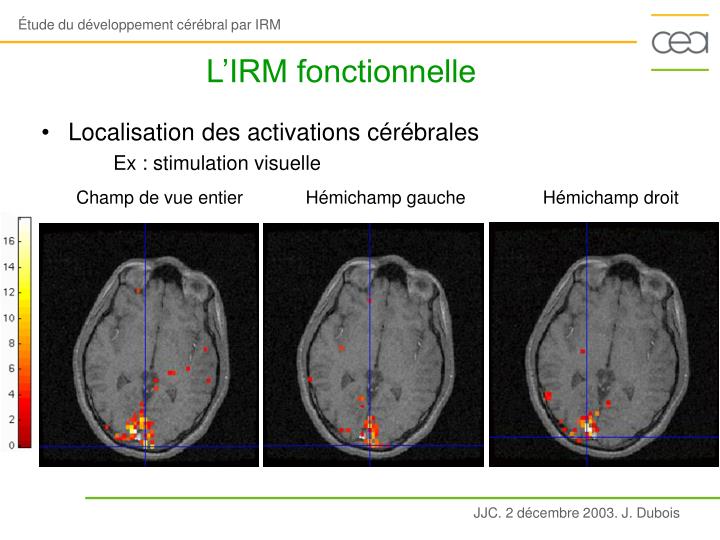 PPT - Étude du développement cérébral par IRM conventionnelle, IRM de ...