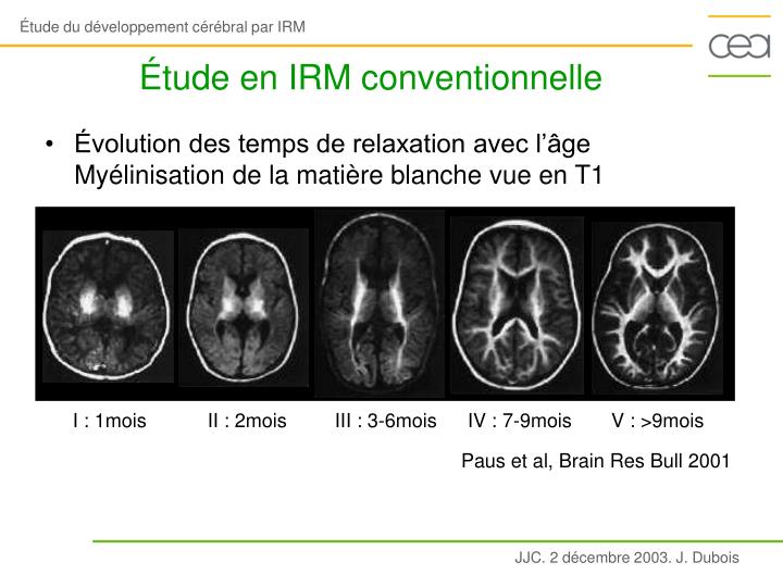 PPT - Étude du développement cérébral par IRM conventionnelle, IRM de ...
