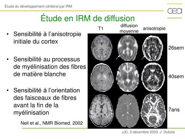 PPT - Étude du développement cérébral par IRM conventionnelle, IRM de ...