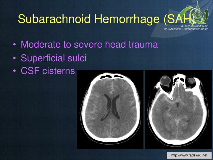 PPT - Basic Knowledge and Film Practices: Head Trauma PowerPoint ...