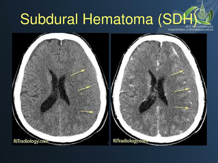 PPT - Basic Knowledge and Film Practices: Head Trauma PowerPoint ...
