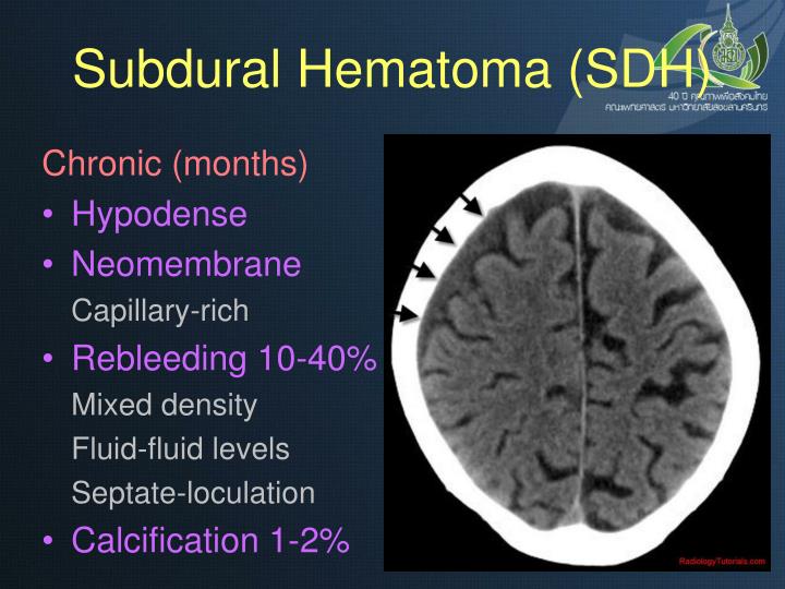 PPT - Basic Knowledge and Film Practices: Head Trauma PowerPoint ...