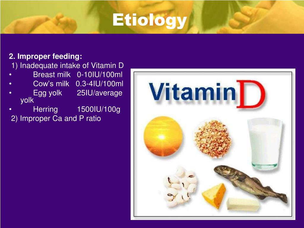 PPT - Rickets: Etiology, pathogenesis, clinical features, diagnostics ...