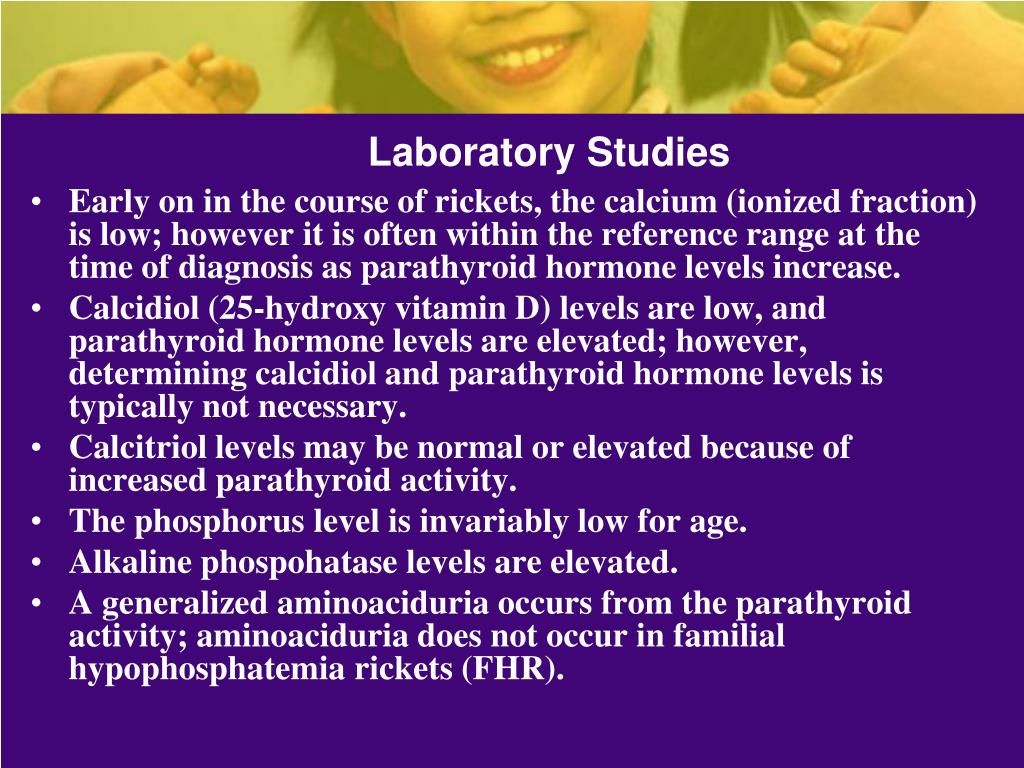 PPT - Rickets: Etiology, pathogenesis, clinical features, diagnostics ...
