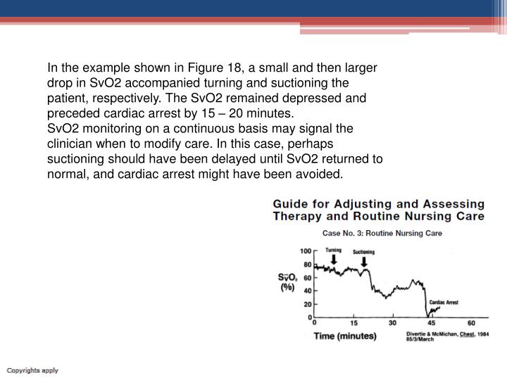 PPT - Sepsis PowerPoint Presentation - ID:3375982