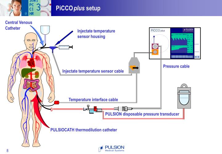 PPT - PiCCO plus PowerPoint Presentation - ID:3376003