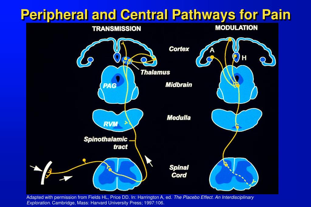 PPT - Etiology and Pathophysiology of Various Pain Syndromes PowerPoint ...