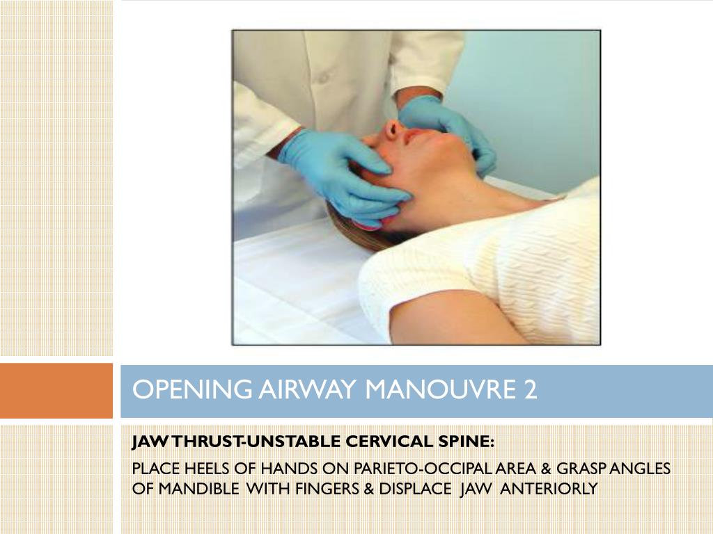 PPT - THE DIFFICULT AIRWAY MANAGEMENT IN ADULT CRITICAL CARE PowerPoint ...