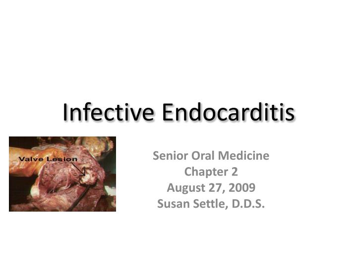 PPT - Infective Endocarditis PowerPoint Presentation, free download ...