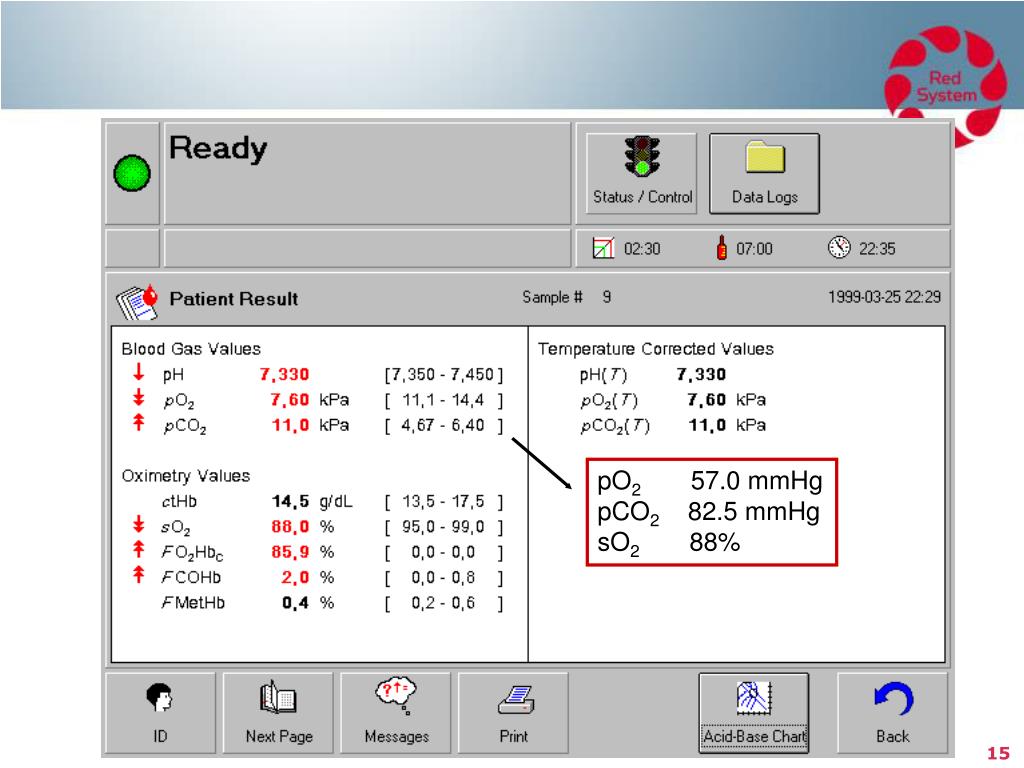 PPT - Radiometer Medical ApS, Åkandevej 21, DK-2700 Brønshøj, Tel: +45 ...