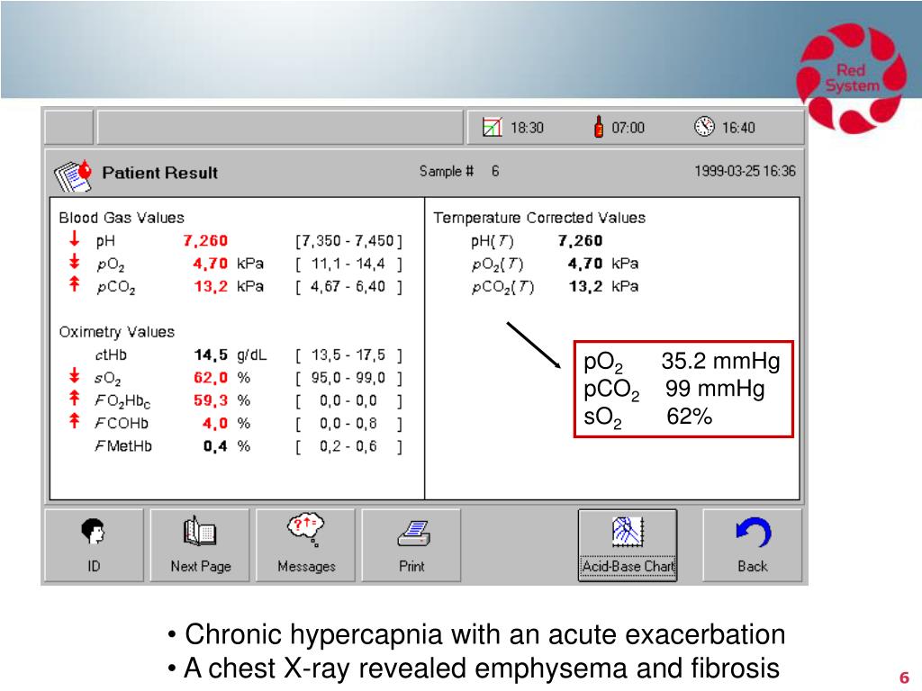 PPT - Radiometer Medical ApS, Åkandevej 21, DK-2700 Brønshøj, Tel: +45 ...