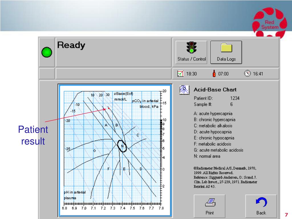 PPT - Radiometer Medical ApS, Åkandevej 21, DK-2700 Brønshøj, Tel: +45 ...