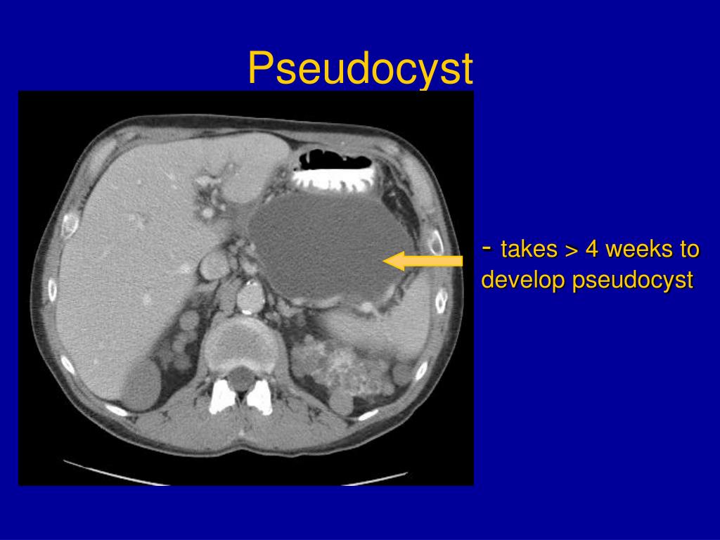 PPT - Gastroenterology Ambulatory Medicine Clerkship PowerPoint ...