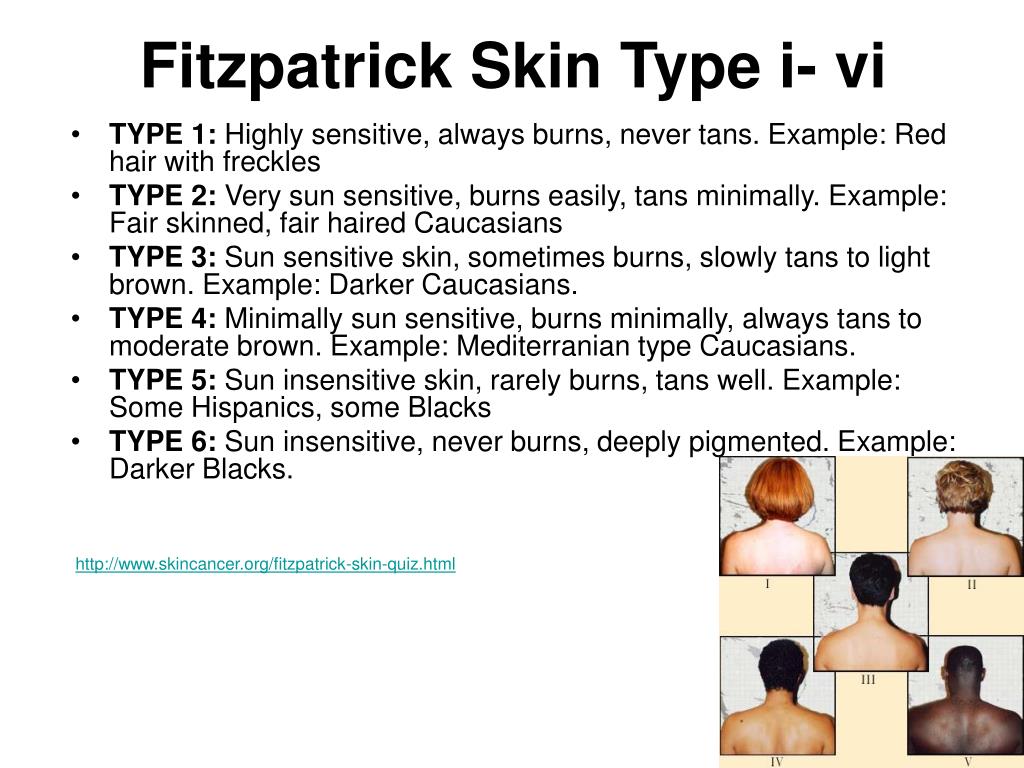PPT - Risk factors for melanoma and non-melanoma skin cancers ...
