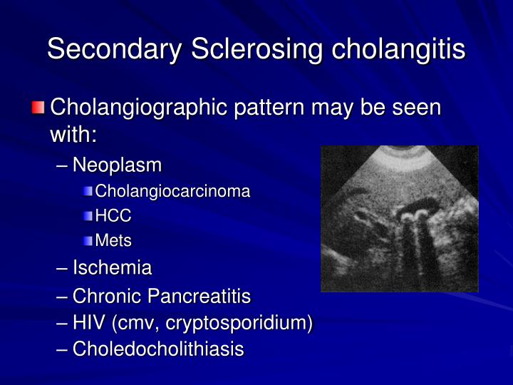PPT - Evaluation of abnormal liver associated enzymes PowerPoint Presentation - ID:3378903