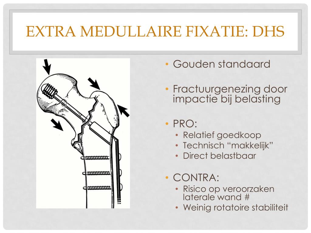 PPT - FIXATIE VAN INSTABIELE PERTROCHANTAIRE FEMUR FRACTUREN PowerPoint ...