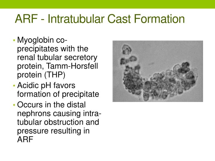 PPT - Rhabdomyolysis PowerPoint Presentation - ID:3380848