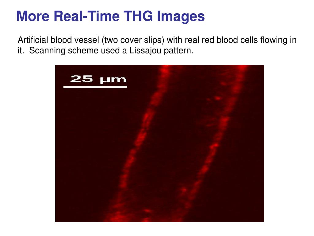 PPT - 18. Medical Imaging with Ultrashort Laser Pulses PowerPoint ...