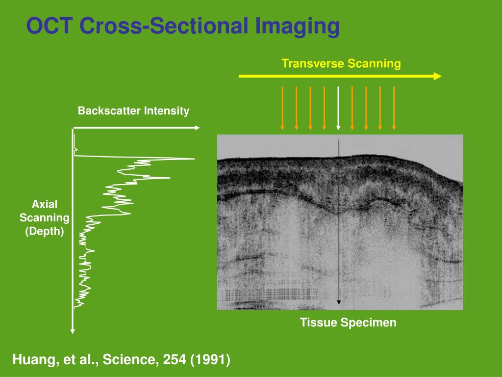 PPT - 18. Medical Imaging with Ultrashort Laser Pulses PowerPoint ...