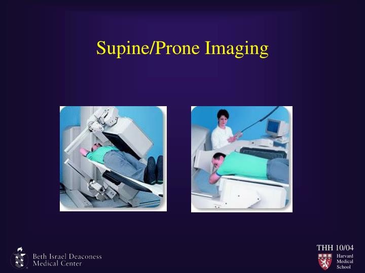PPT - Attenuation Artifacts PowerPoint Presentation - ID:3380940