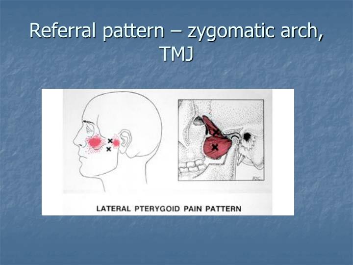 PPT - Evaluation & Treatment of TMD PowerPoint Presentation - ID:3381918