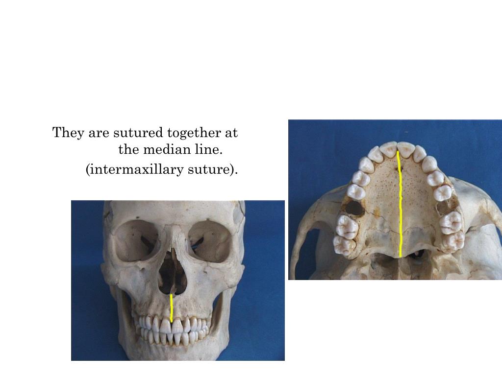 PPT - skull BY: DR.Yahya Alfarra CANADIAN BOARD IN DENTISTRY PowerPoint ...